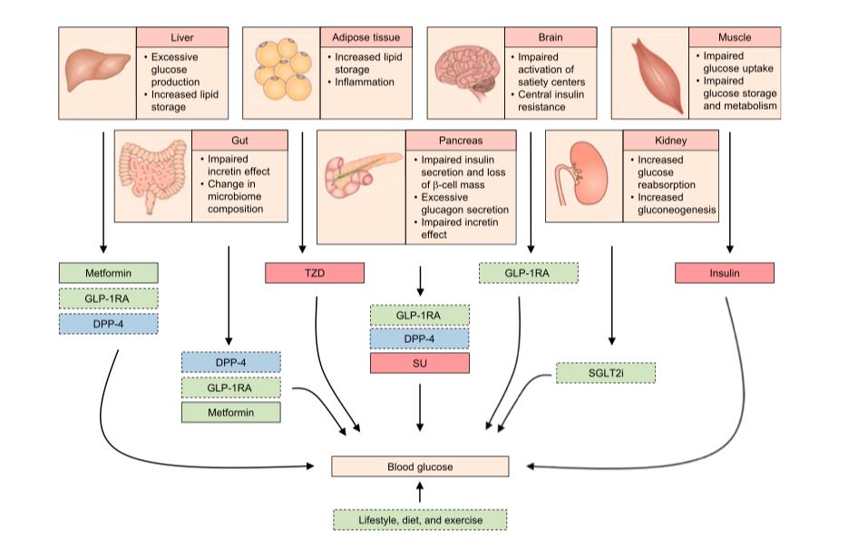 Diagrama De Fisiopatología De La Diabetes Tipo 2