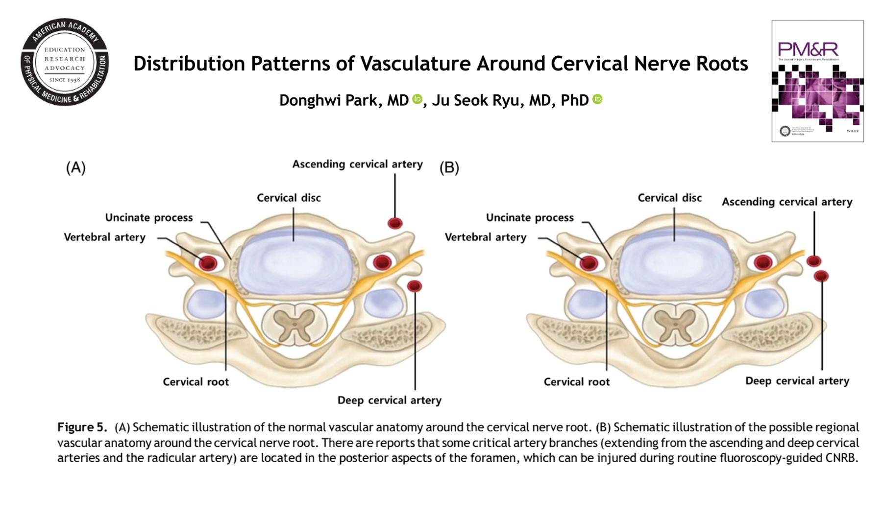 Cervical Root Distribution