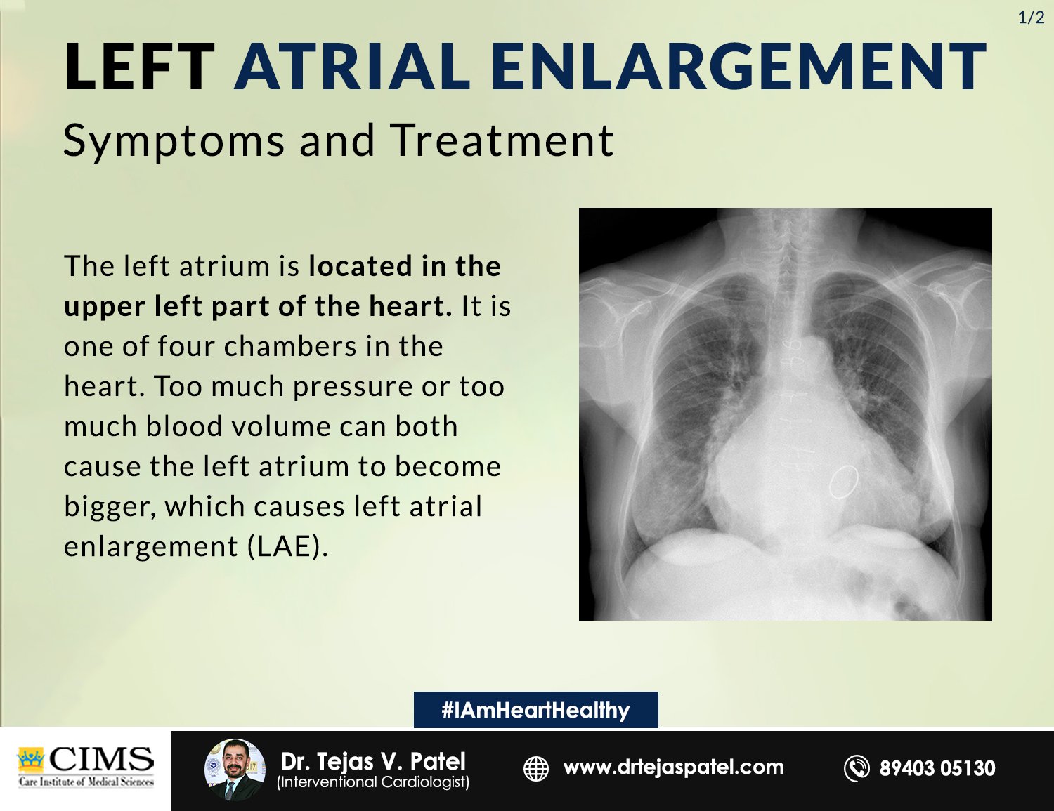 Left Atrial Enlargement X Ray