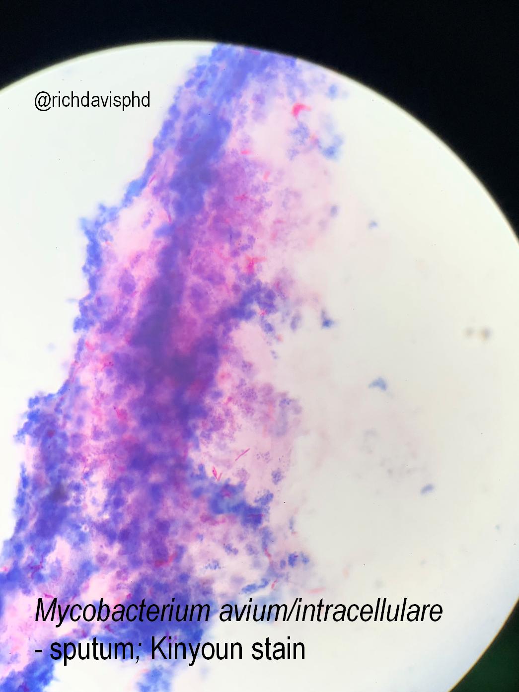 Mycobacterium Smegmatis Acid Fast Stain