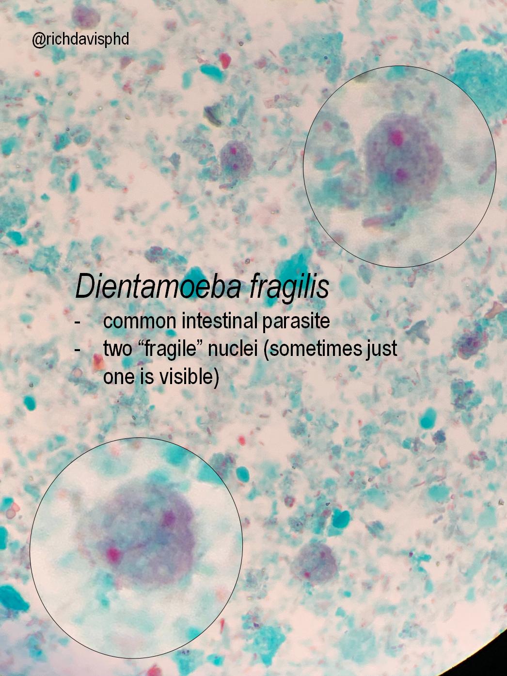 Dientamoeba Fragilis Troph