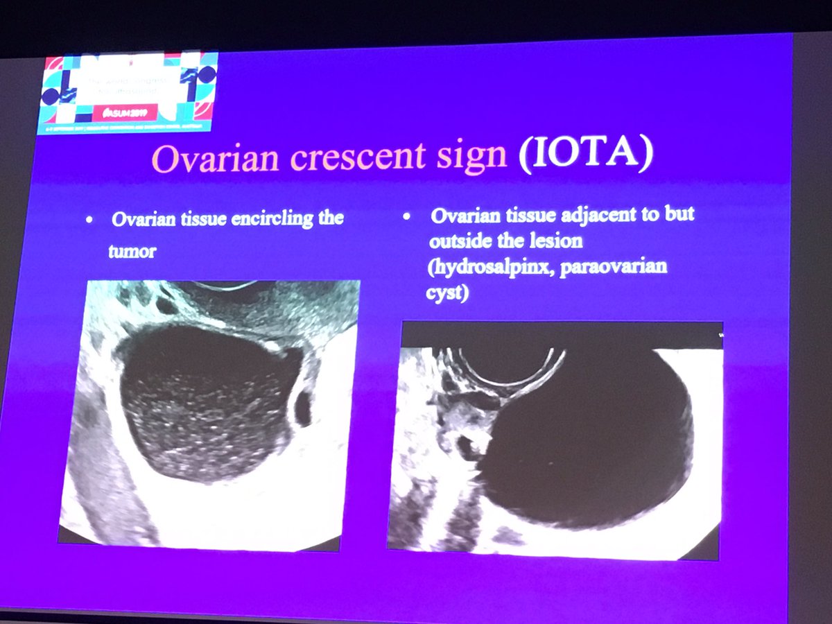 Thread by @UCUltrasound: "A/Prof George Condous encouraging a ...