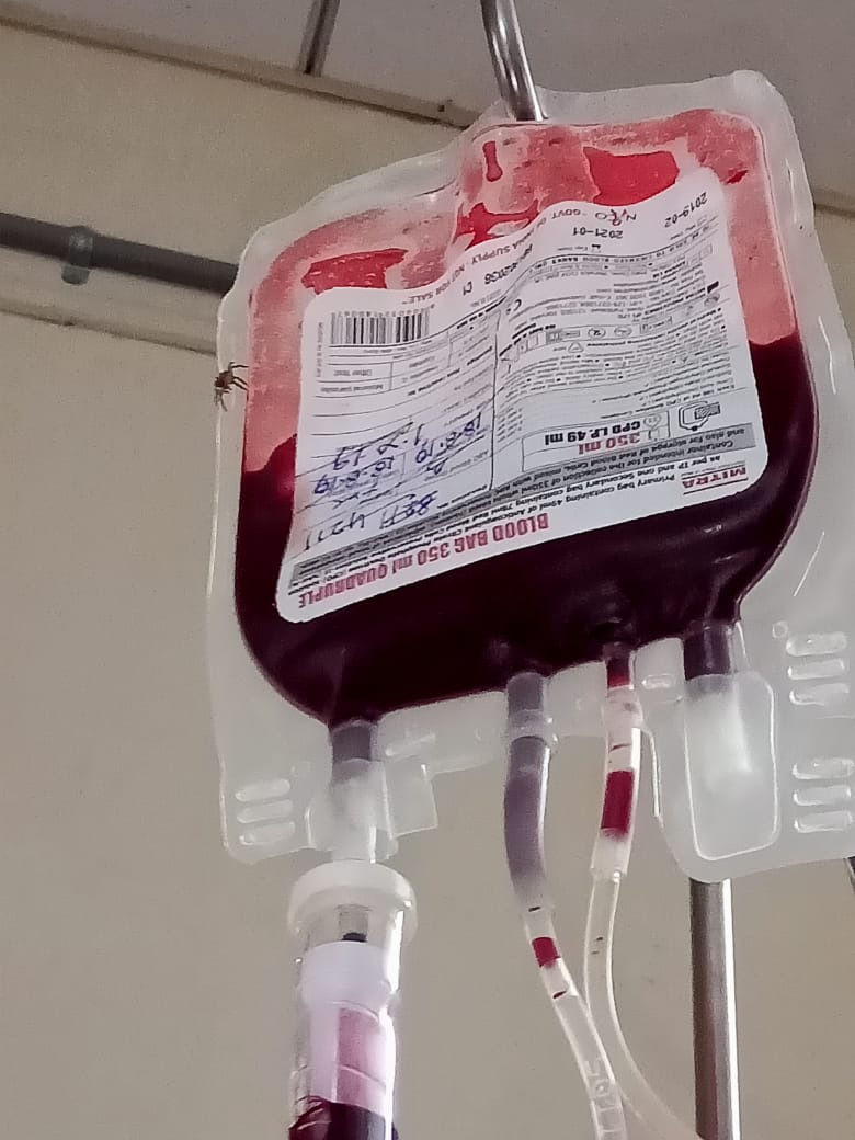 Filter For Platelet Transfusion