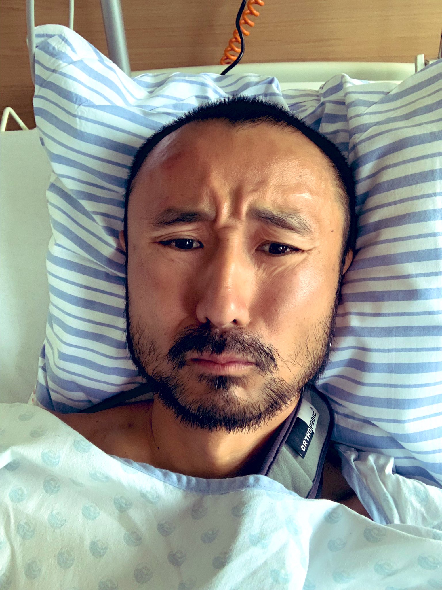 Kyosuke Takei on Twitter: "😢😢😢😢😢 生まれて初めて鎖骨骨折 救急車に乗りました フランス語で入院しました 良くない折れ方で明日手術ナウ かわいそうな僕です まぁ ...