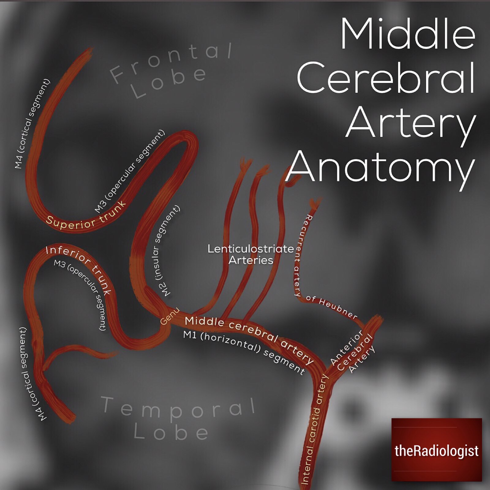 Middle Cerebral Artery Mri