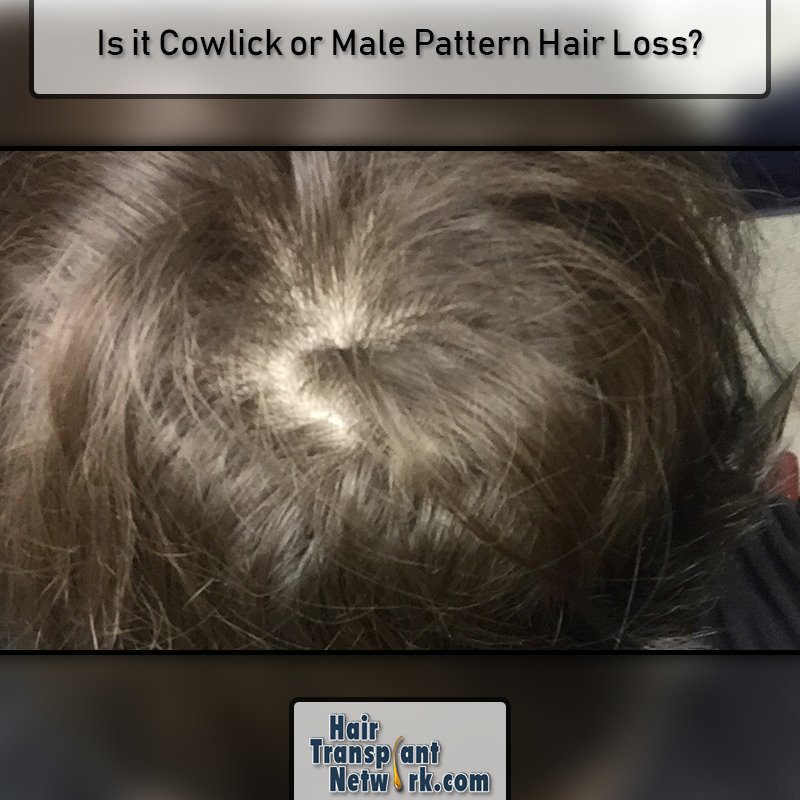 Cowlick Hairstyles Men