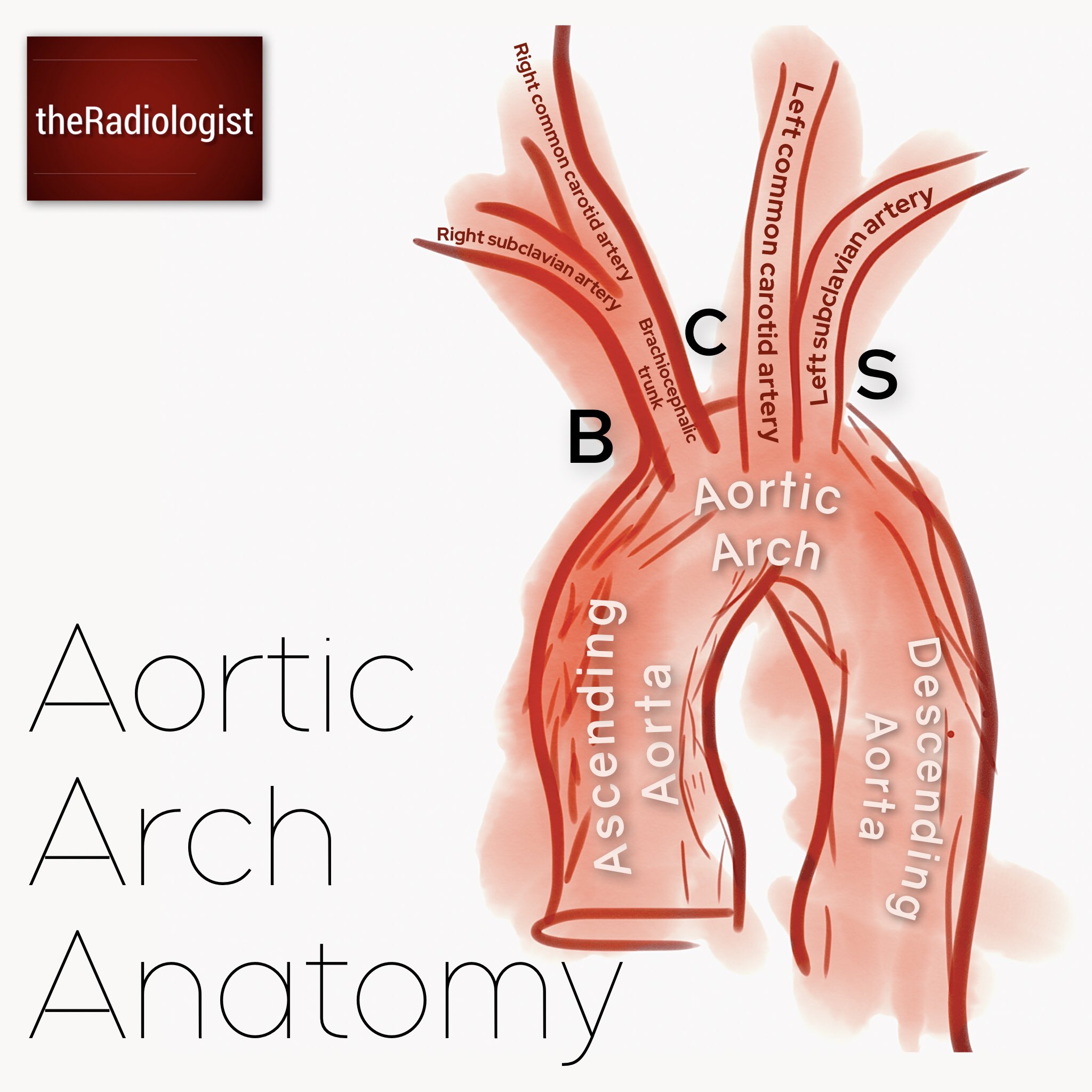 Brachiocephalic Artery