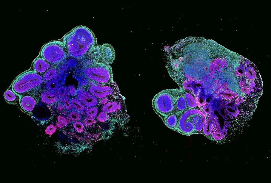 Fluorescence confocal micrograph of human cerebral organoids labeled ...