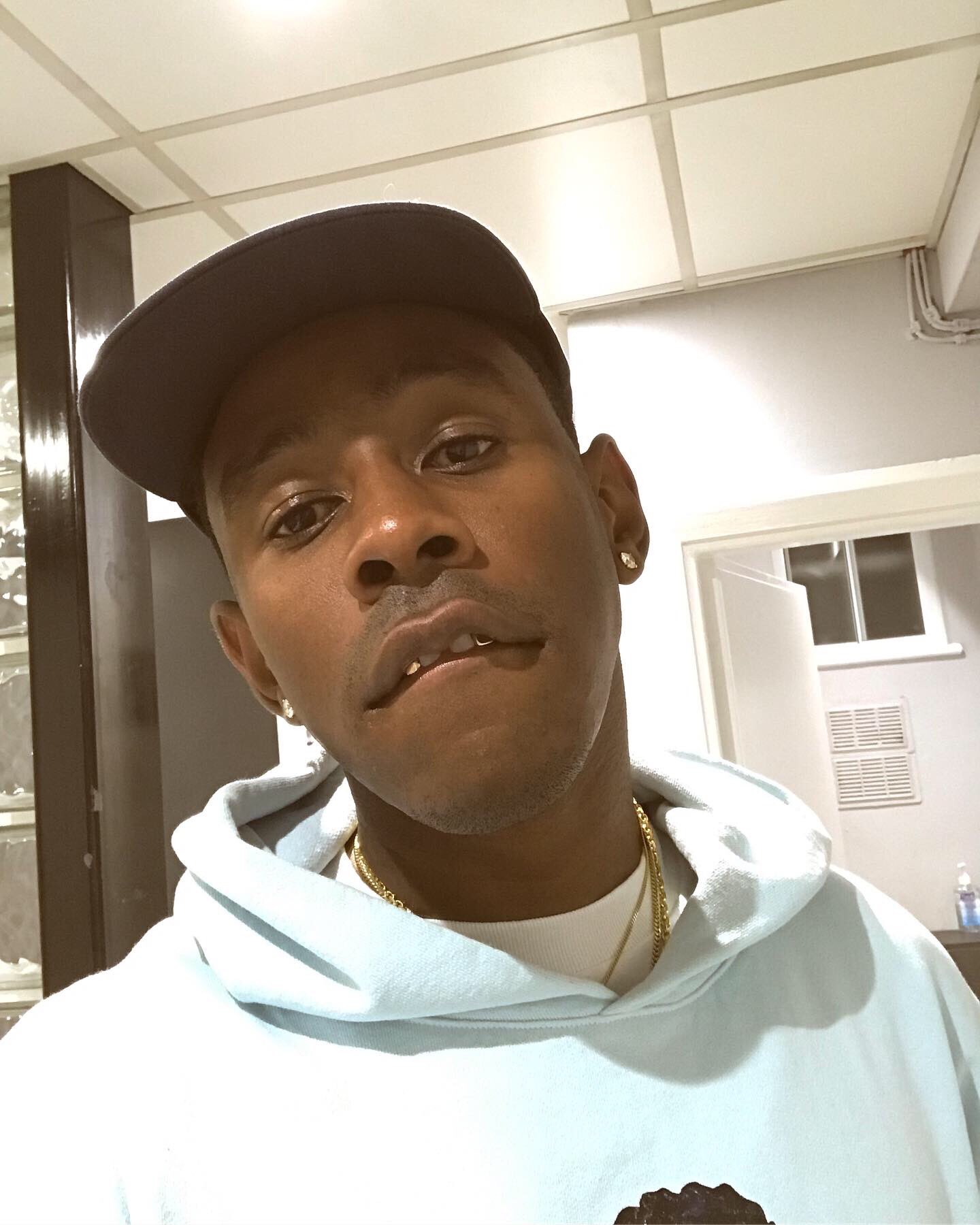 Tyler The Creator Hairline