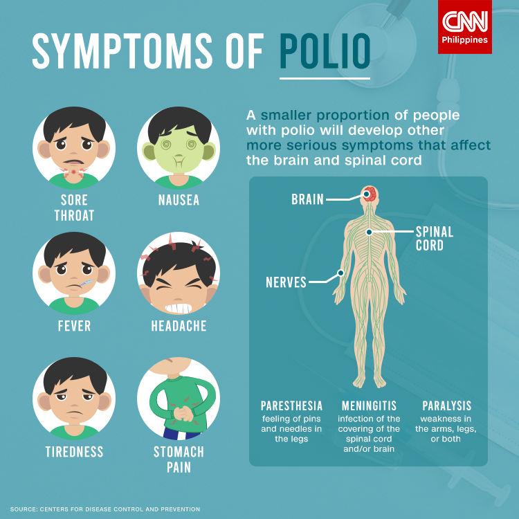 Polio Symptoms And Causes