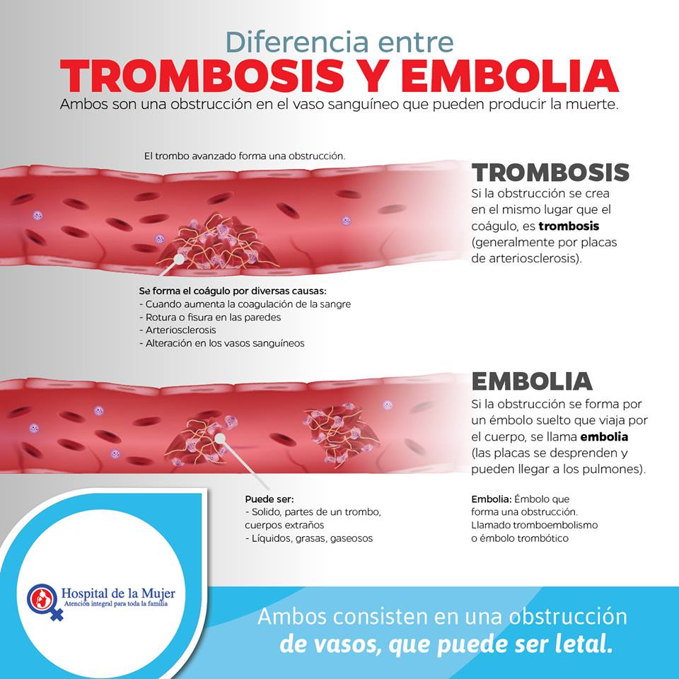 Diferença Entre Trombo E Embolo - RETOEDU