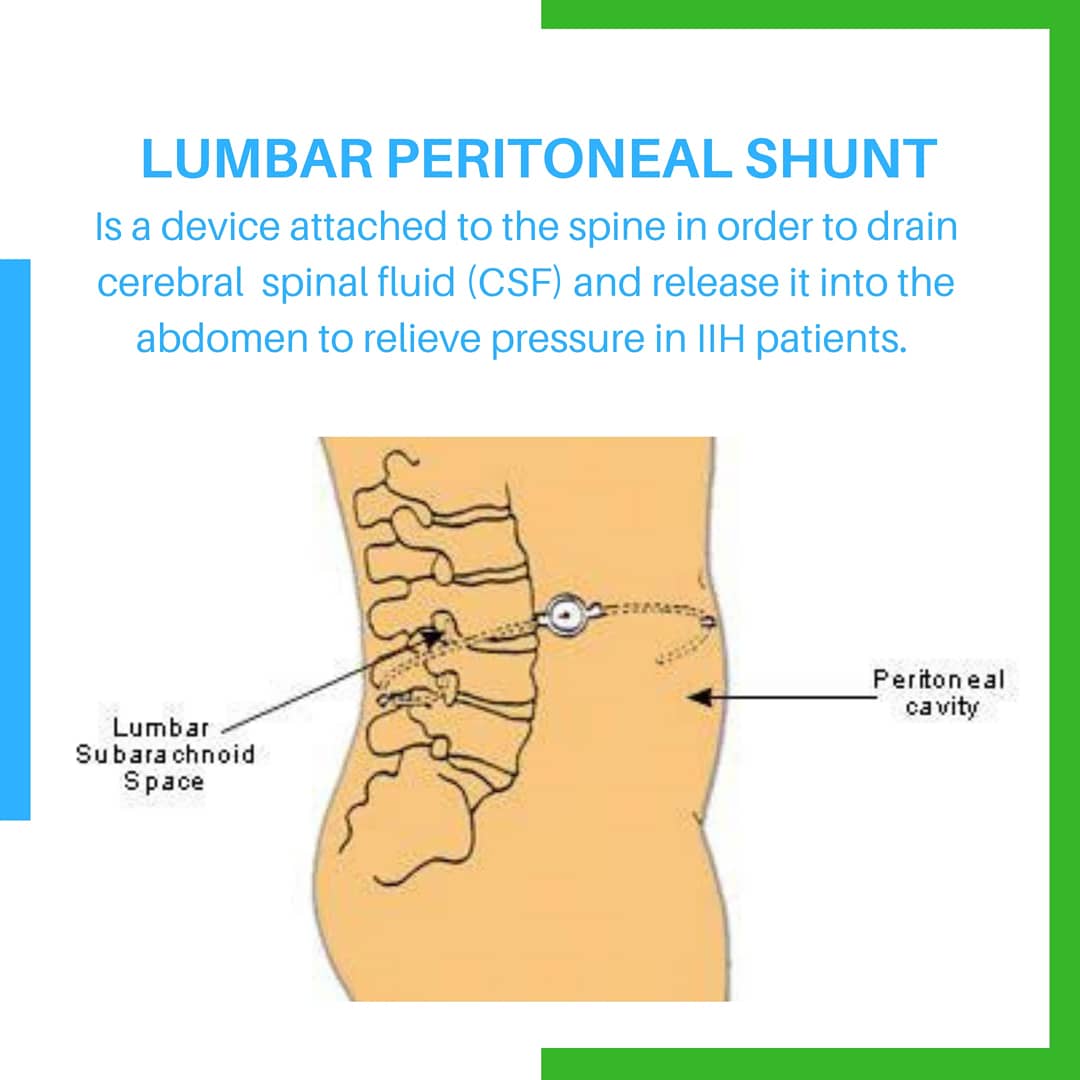 Peritoneovenous Shunt
