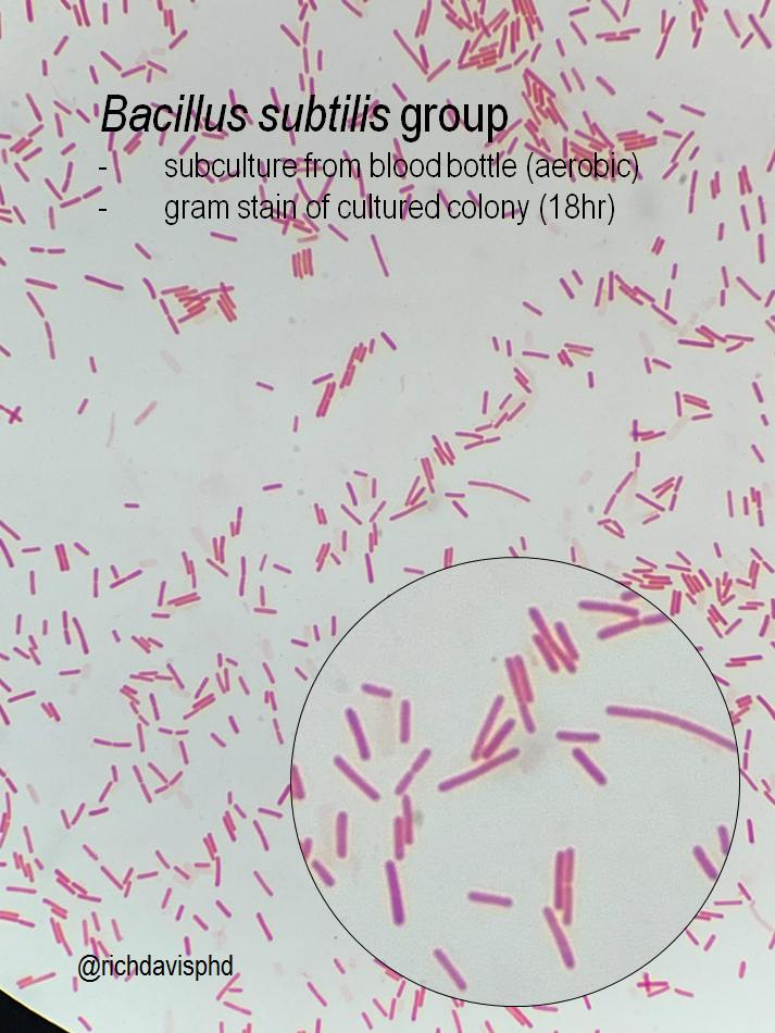 Bacillus Subtilis Spore Stain
