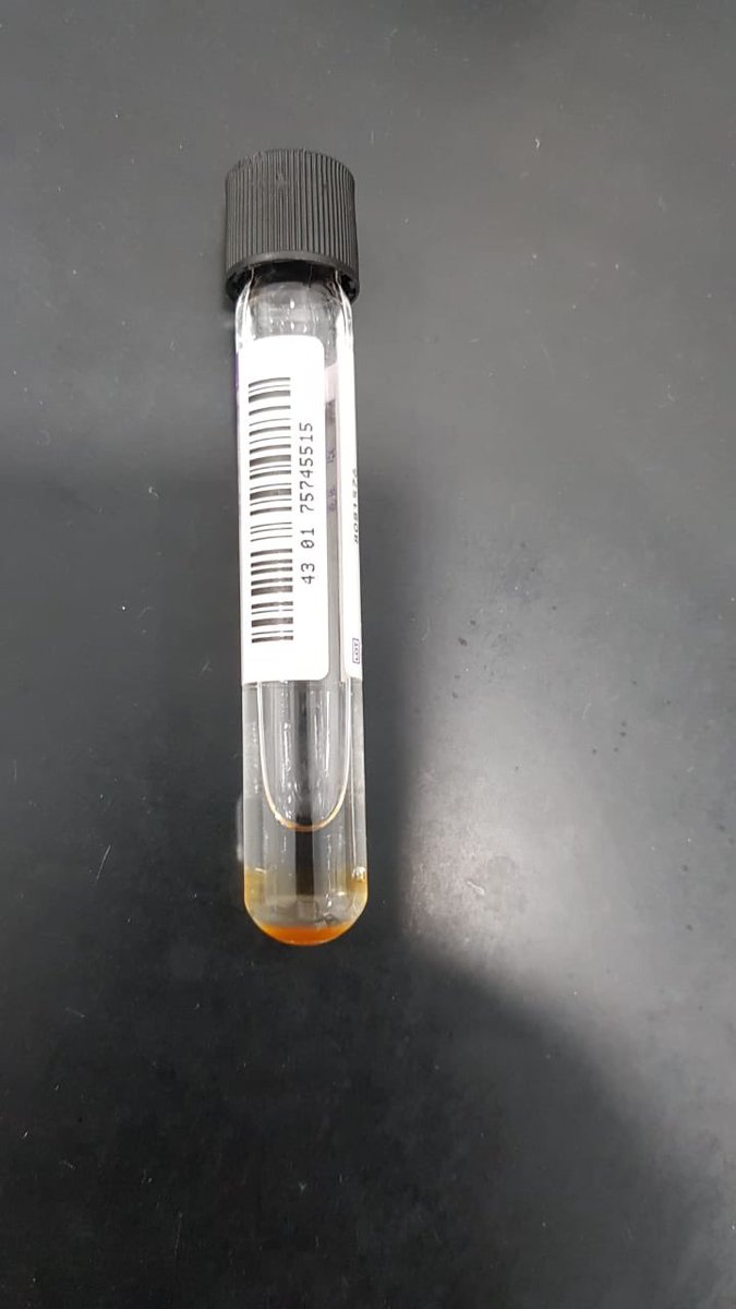 العينة smear from positive culture لمريض درن هذه العينة تم عملها على ...