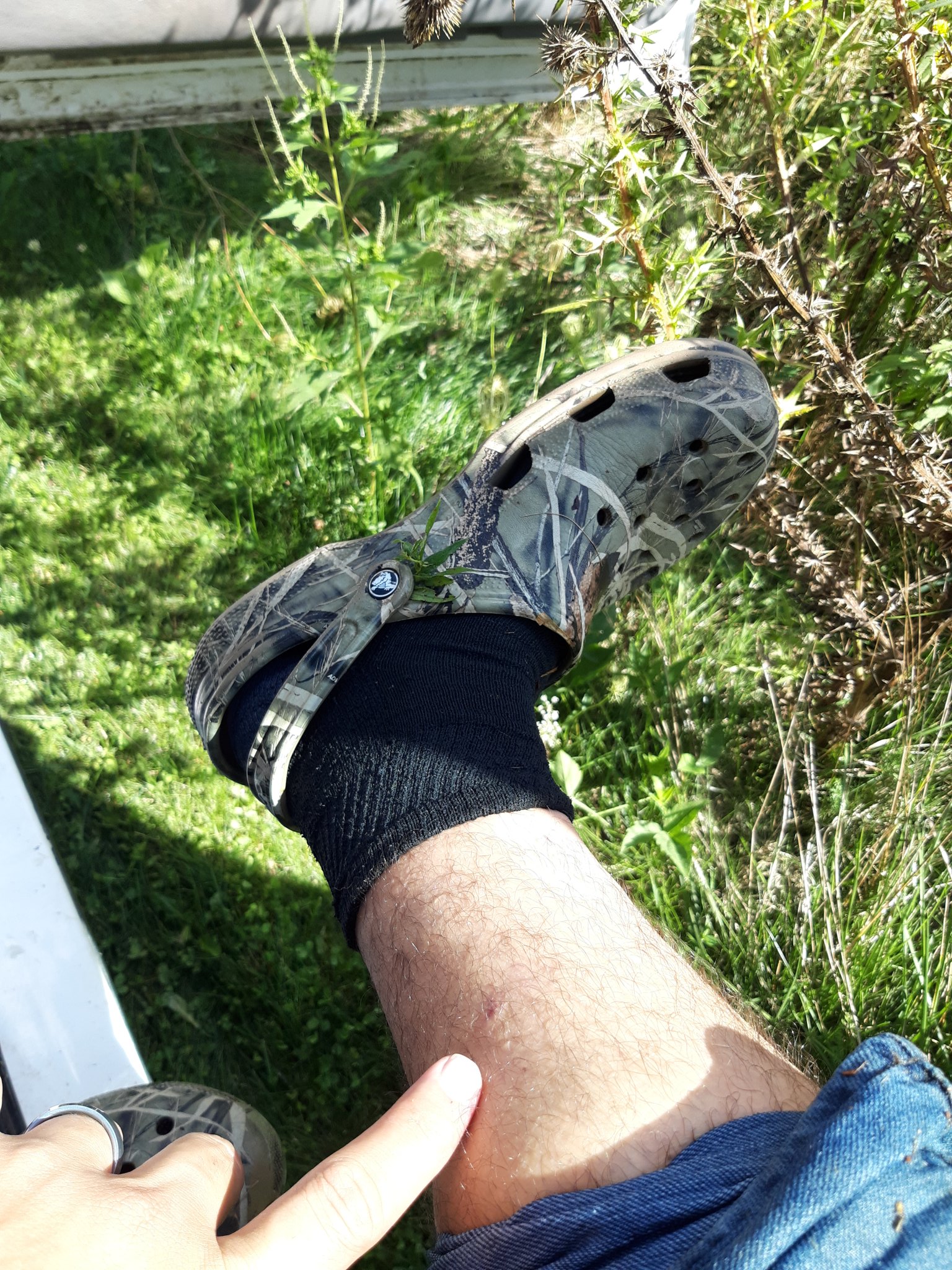 Snapping Turtle Bite