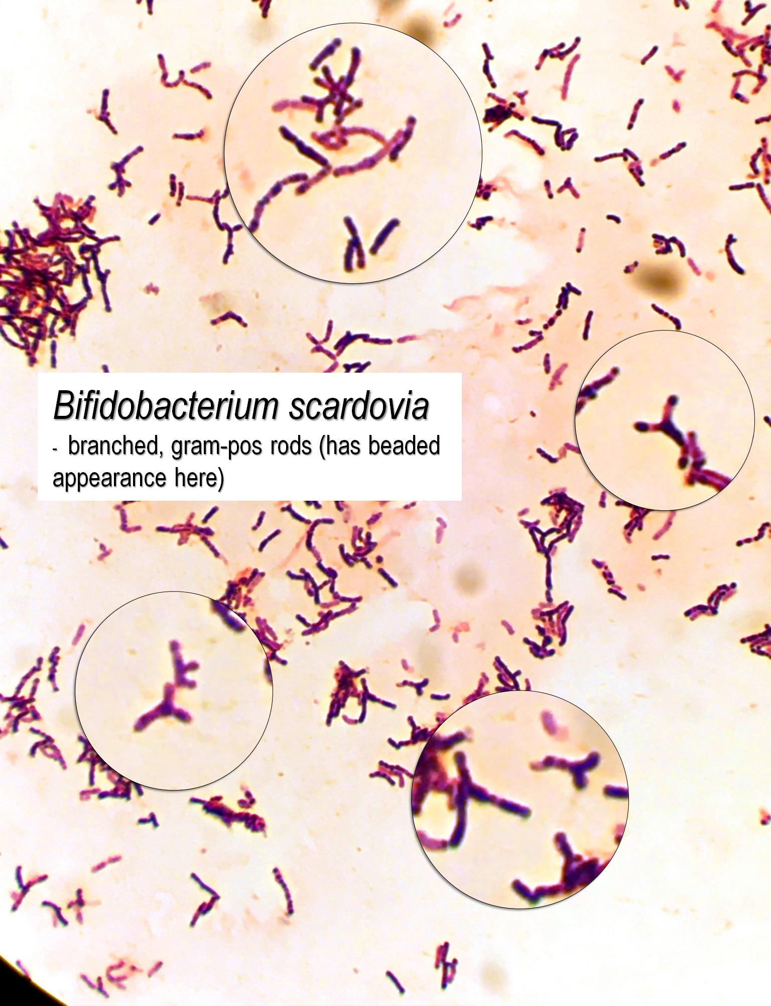 Bifidobacterium Gram Stain