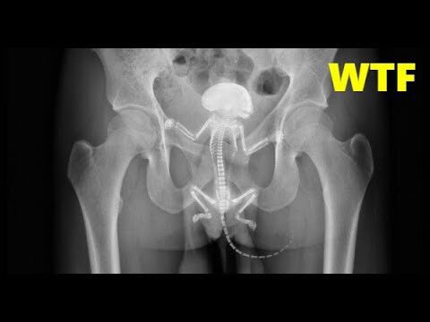 Weird X Rays