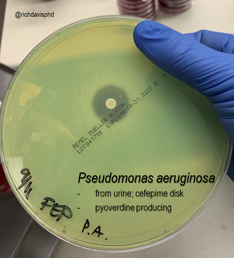 Pseudomonas Aeruginosa Streak Plate