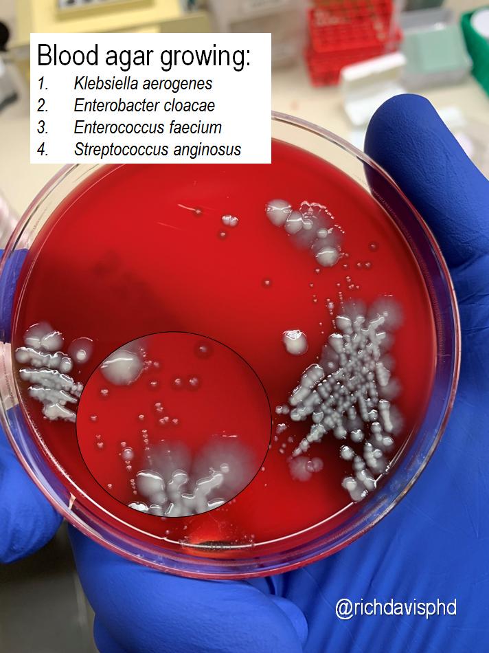 Macconkey Agar Enterobacter Aerogenes