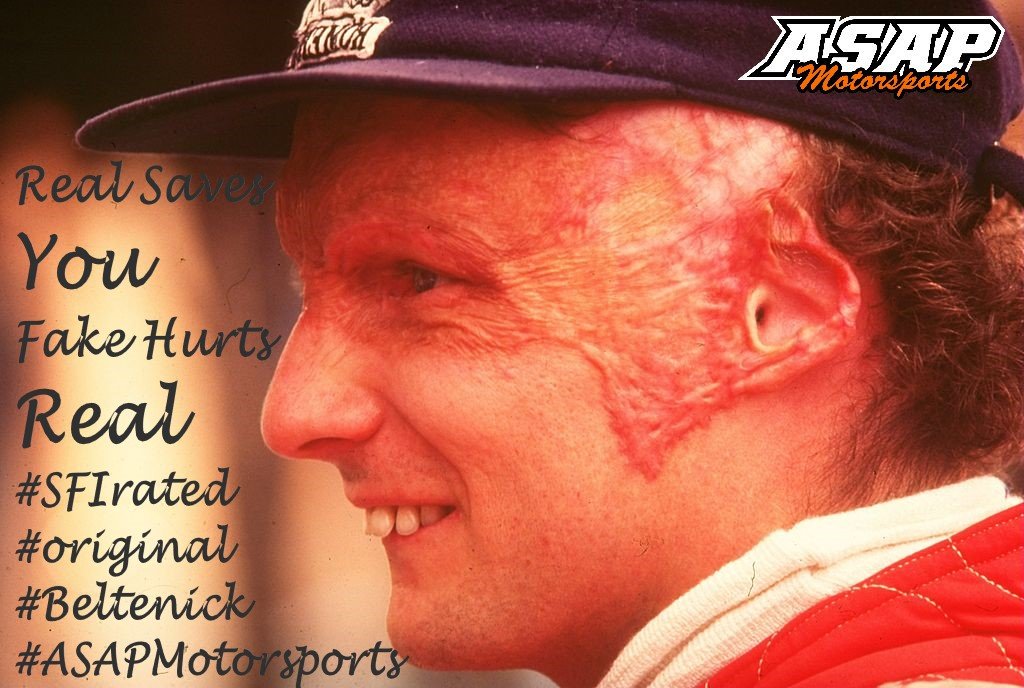 Niki Lauda Ear