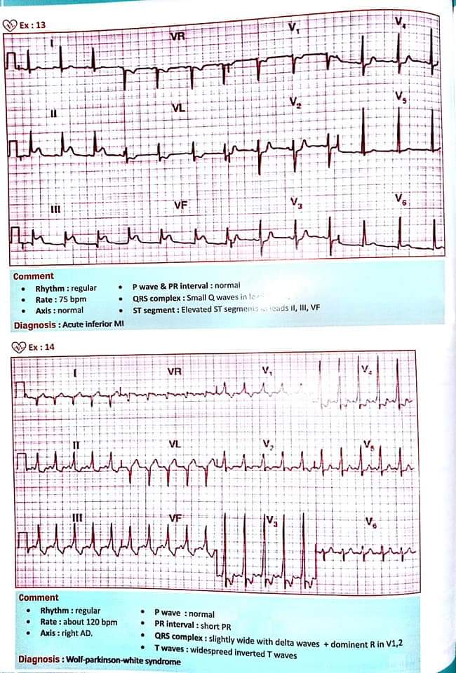 تحت هذه التغريده Comment on ECG - المسلسل من ماجد الحريبي | صيدلي ...