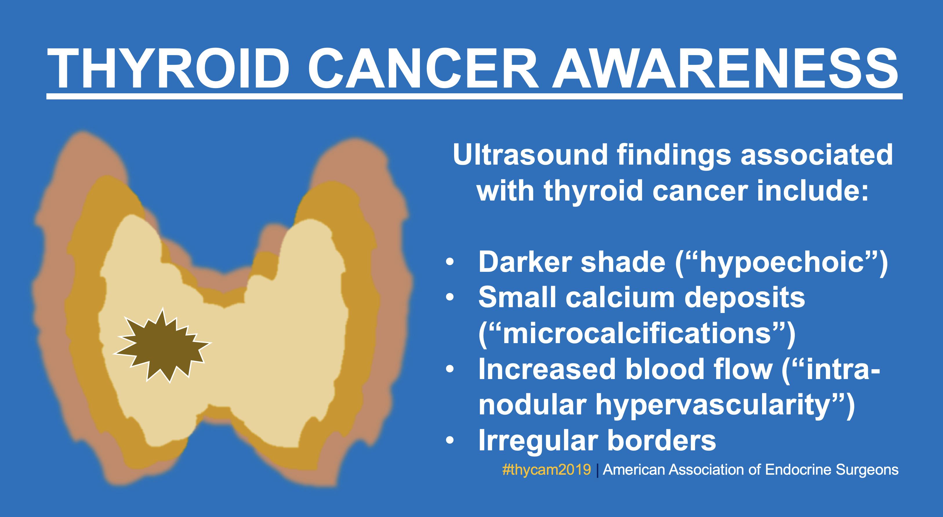 Thyroid Cancer Ultrasound