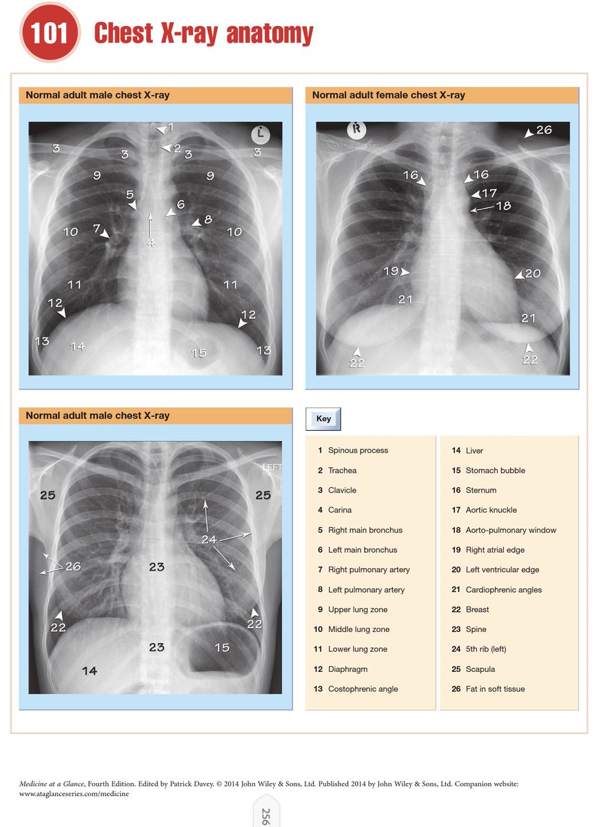 Normal Radiographic Anatomical Landmarks In 2021 Anatomical
