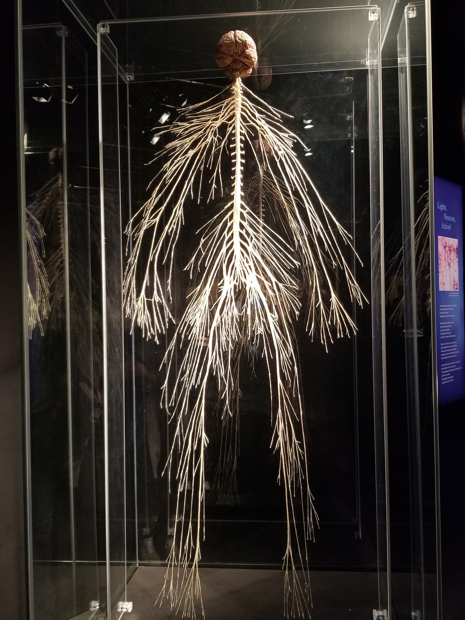 Accusateur Épaissir Roux body worlds nervous system Succulent ... Accusateur Épaissir Roux body worlds nervous system Succulent ...