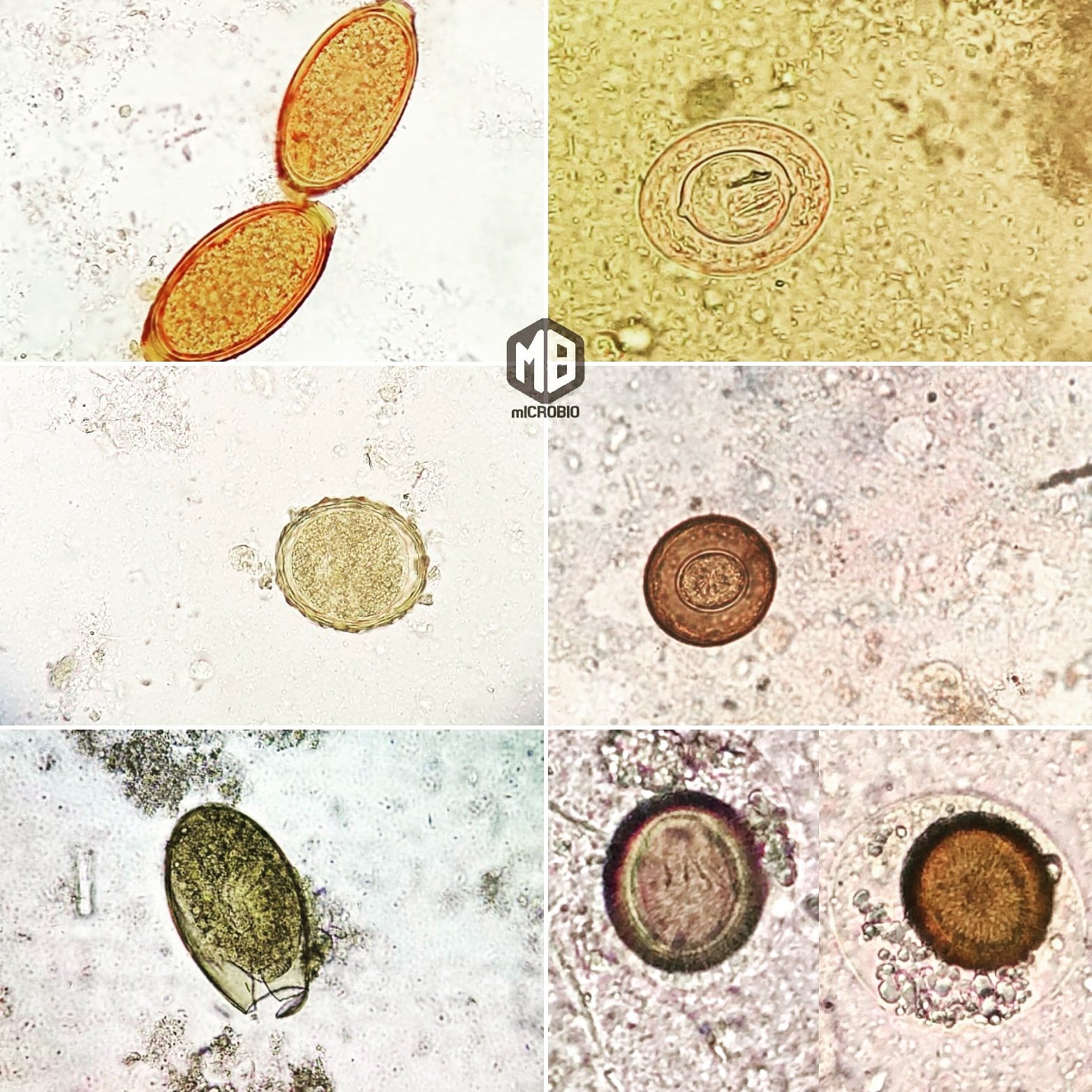 Hymenolepis Diminuta