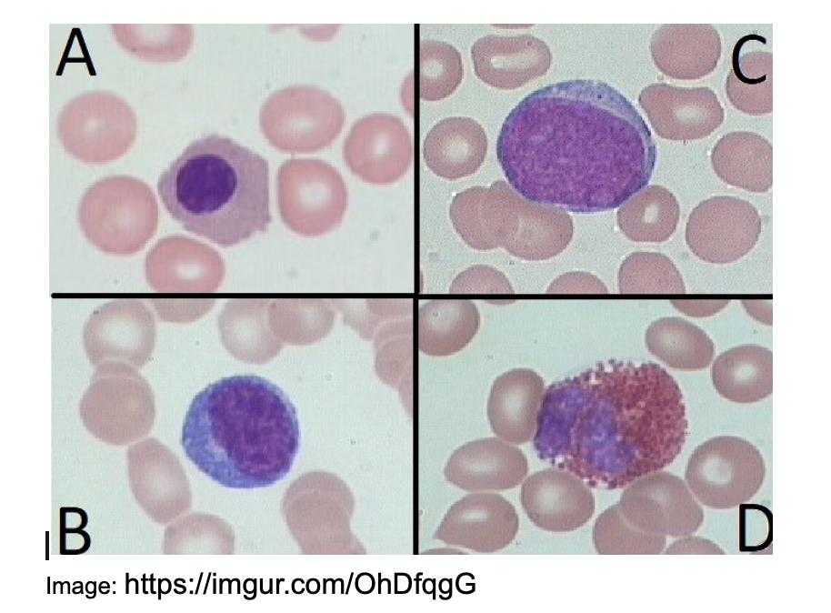 Blast Peripheral Blood