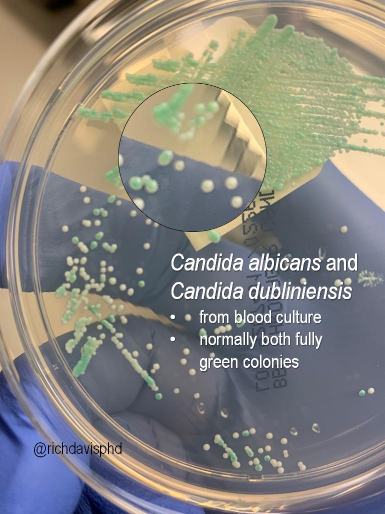 Candida Albicans Culture