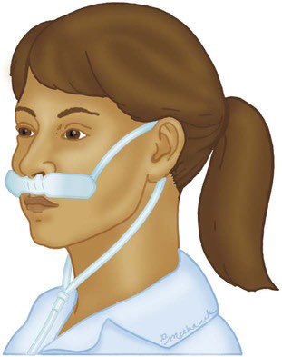 Reservoir Nasal Cannula 1.5M Soft Disposable Nasal Cannula Tube Safe