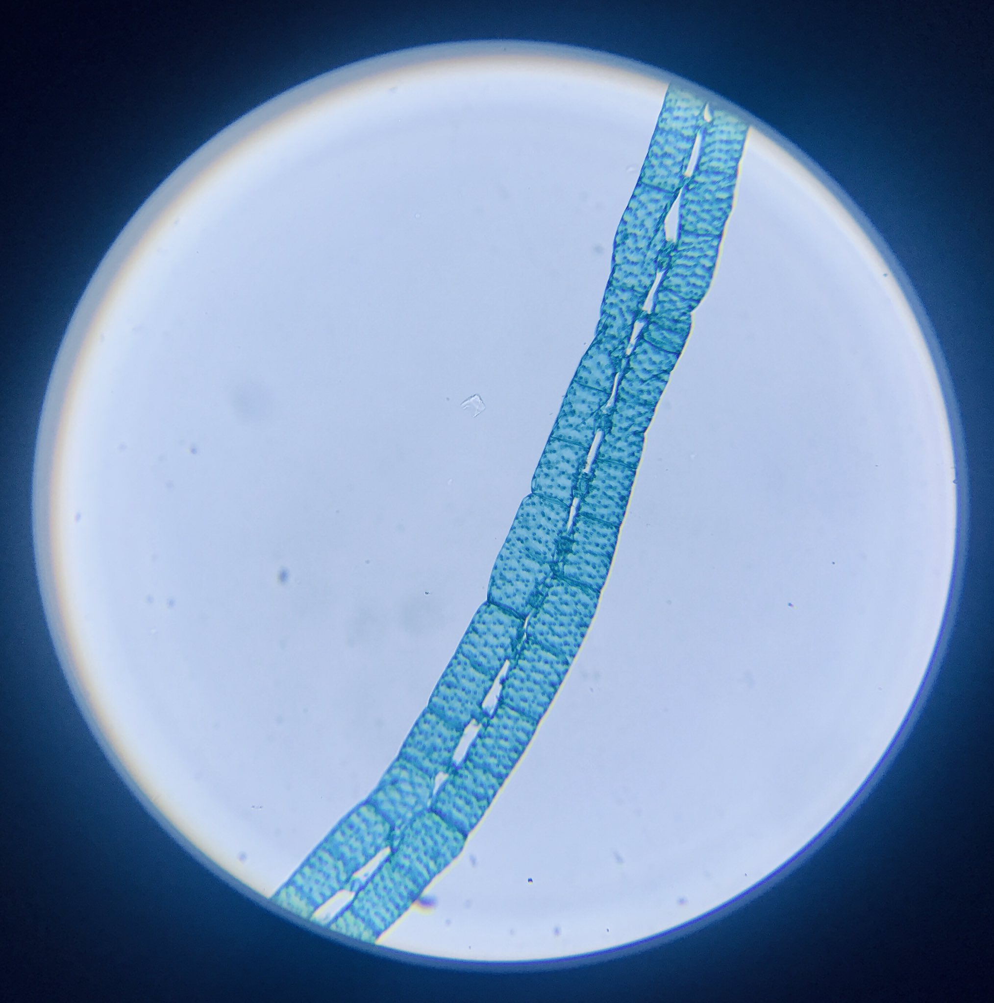 Spirogyra Under Compound Microscope