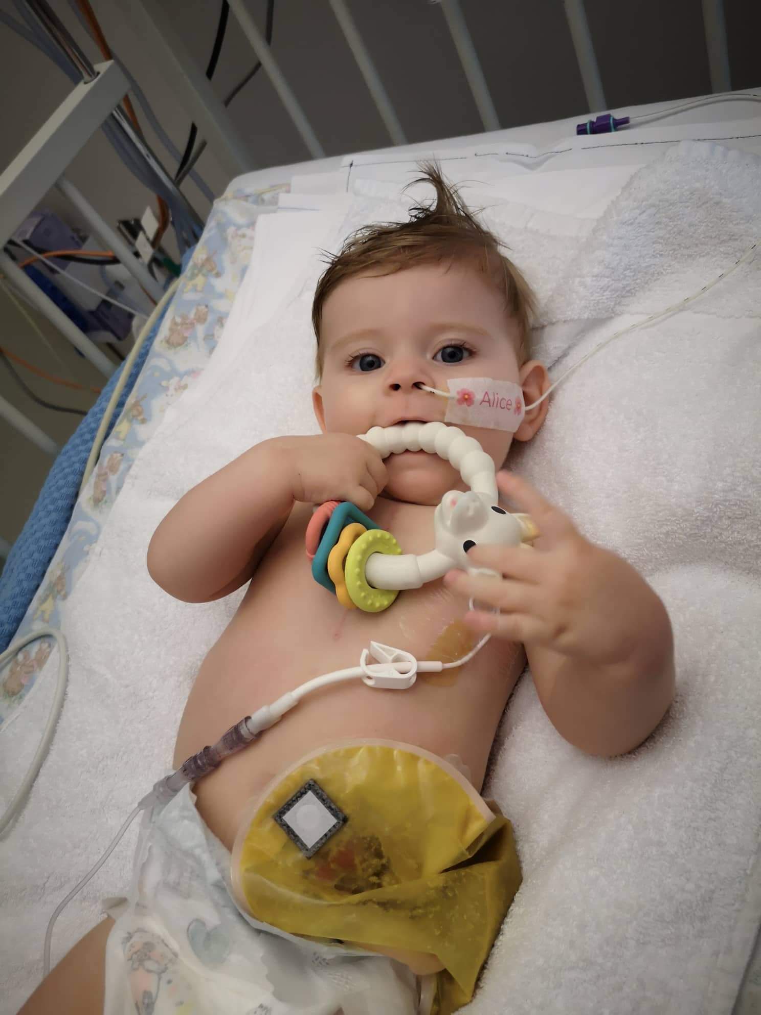 Ostomy — Our Life After NICU, 47% OFF