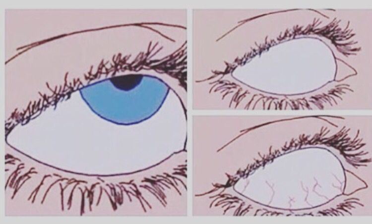 Drawing Eyes Rolled Back