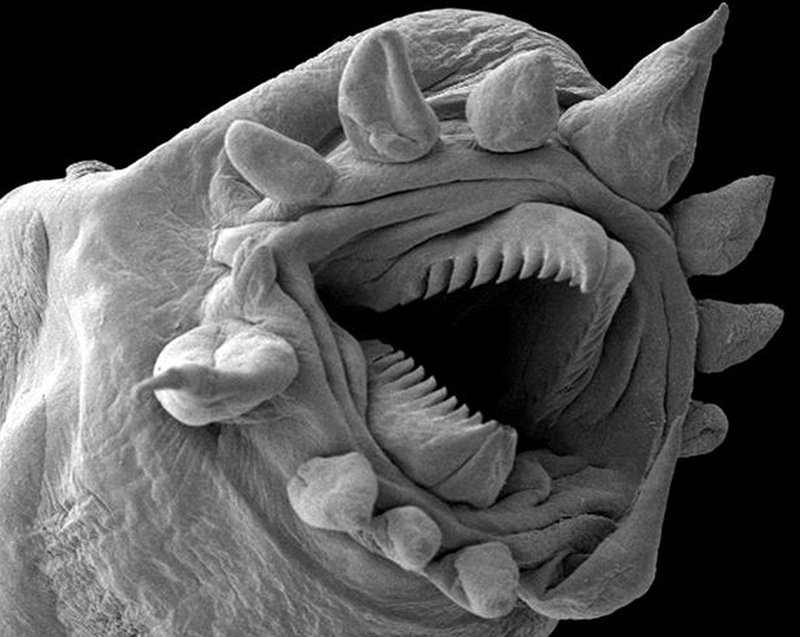 Electron Microscope Images Of Insects