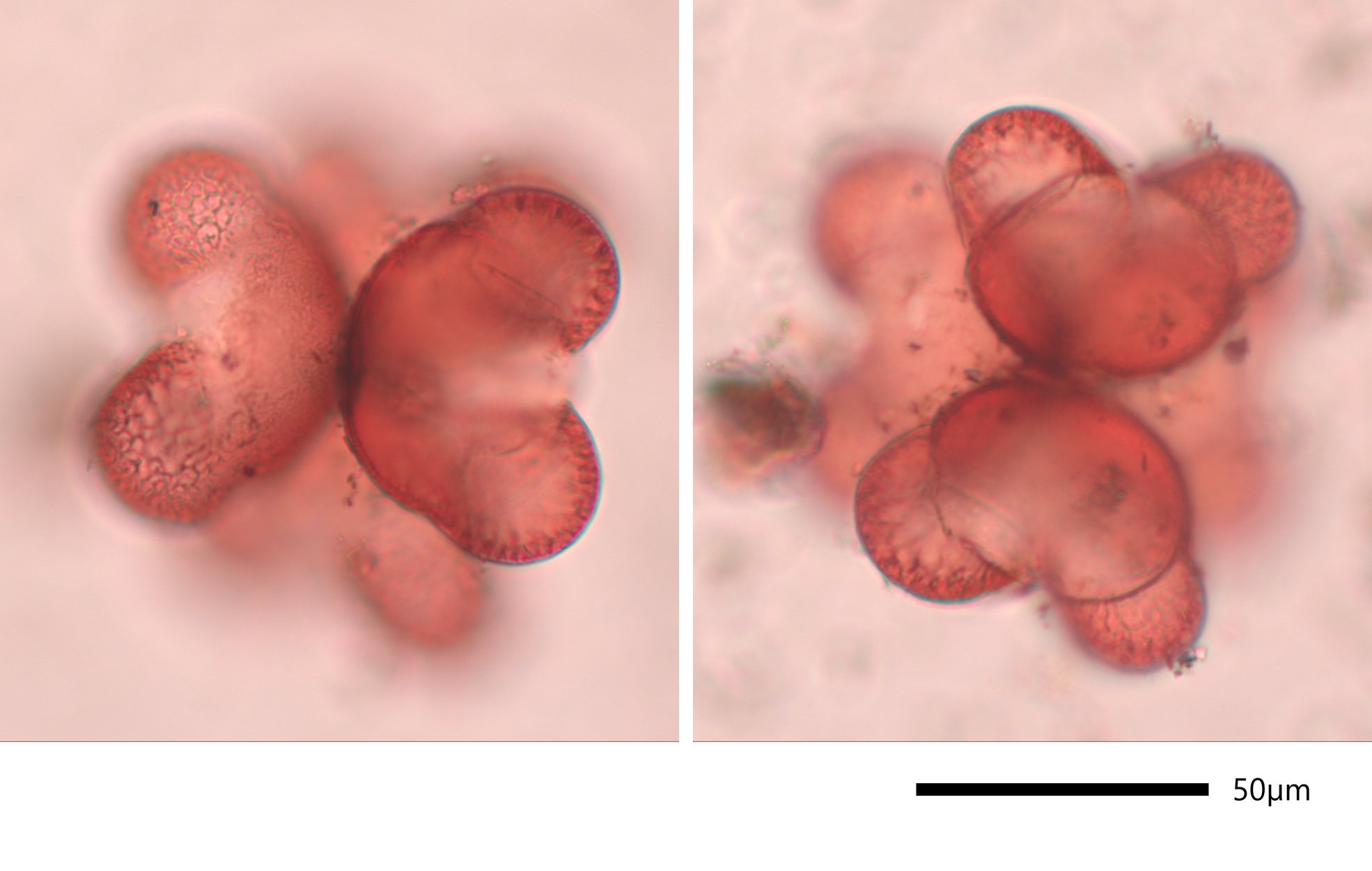 Pine Pollen Microscope