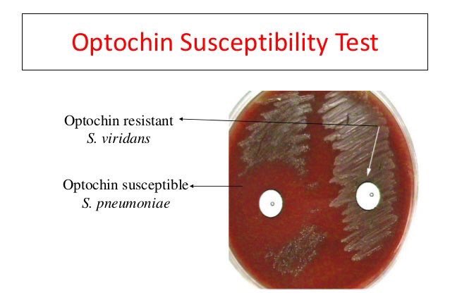 ♦️ القسم : MICROBIOLOGY 🧪 الإختبار : ANTIBIOTIC DISC TESTS شرح سريع ...