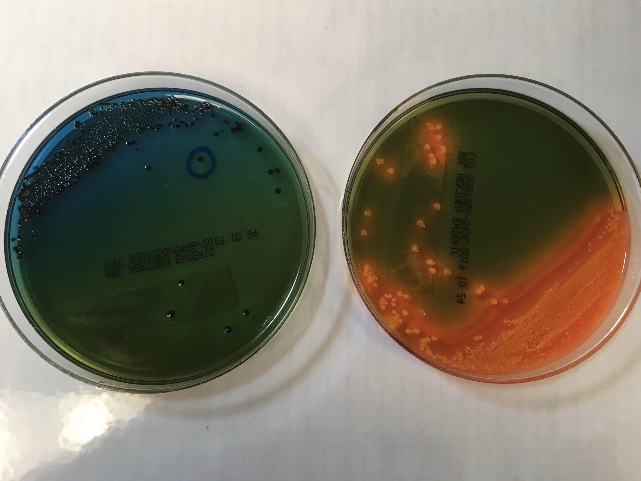 Hektoen Enteric Agar