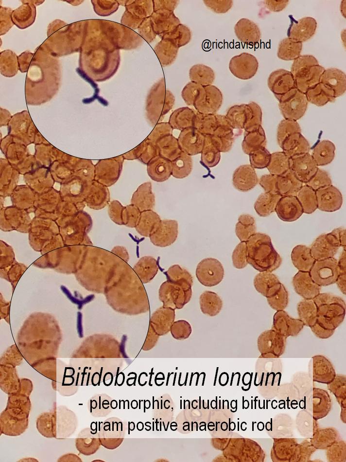 Bifidobacterium Gram Stain