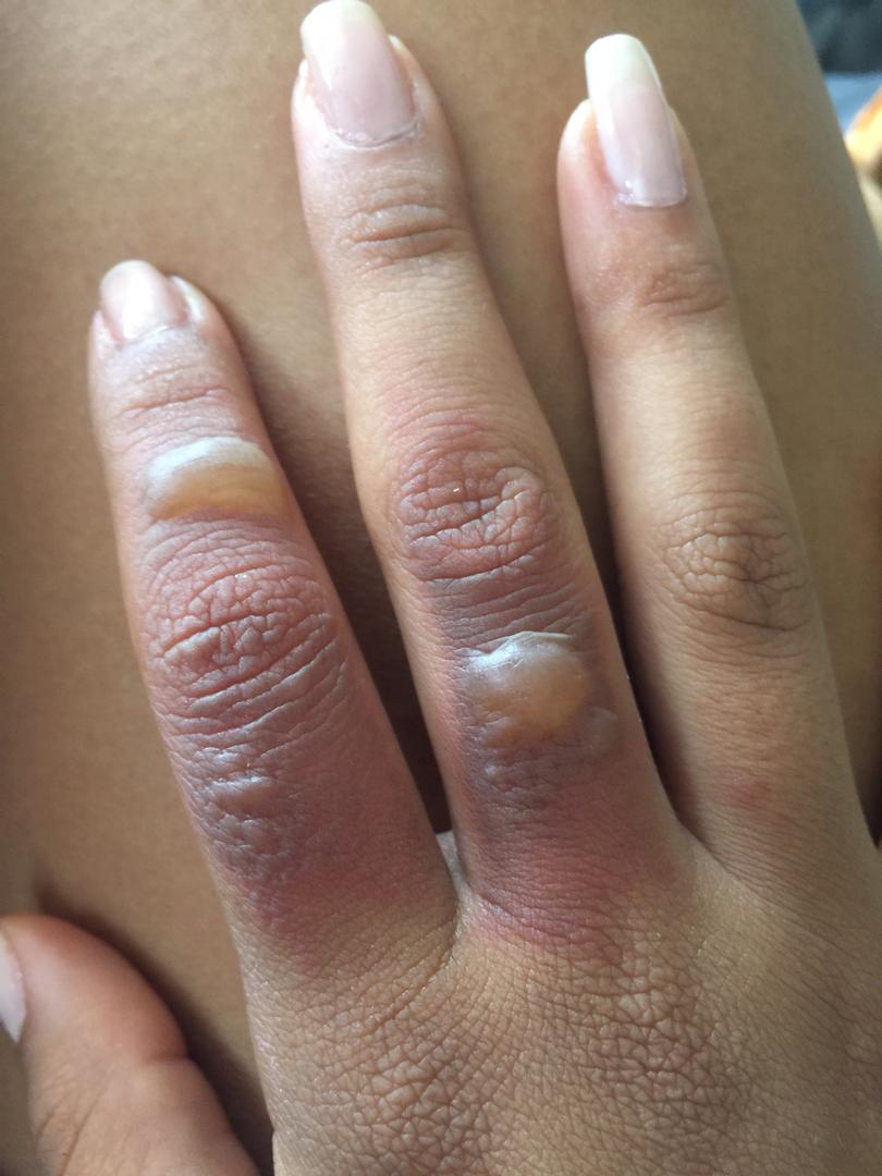 Más grande sistema menú quemaduras con aceite cera diagonal Paradoja