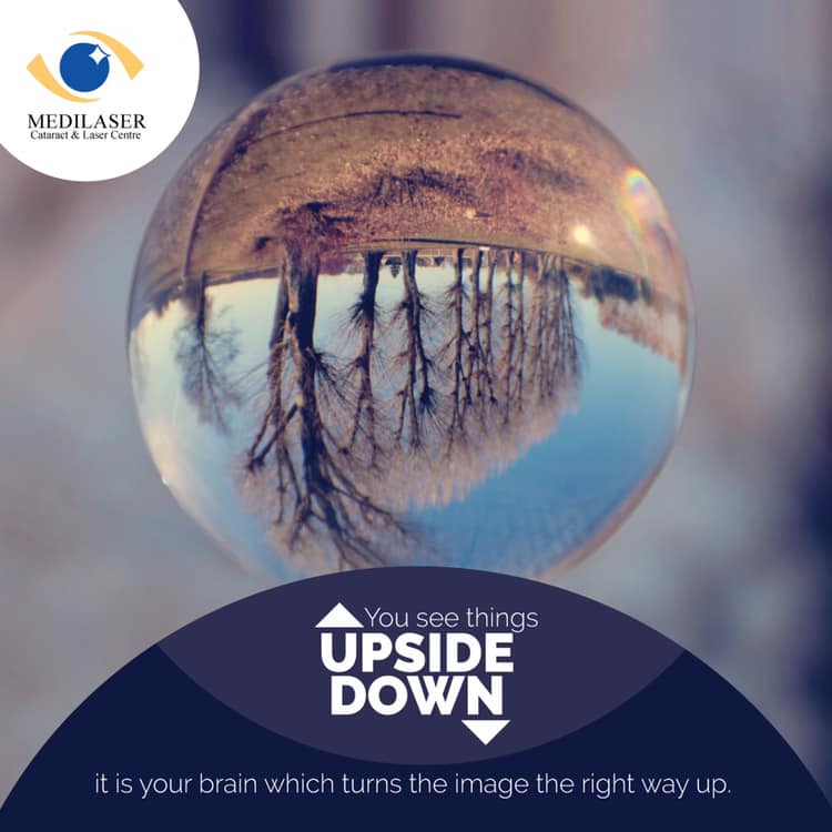 Upside Down Eyes Retina