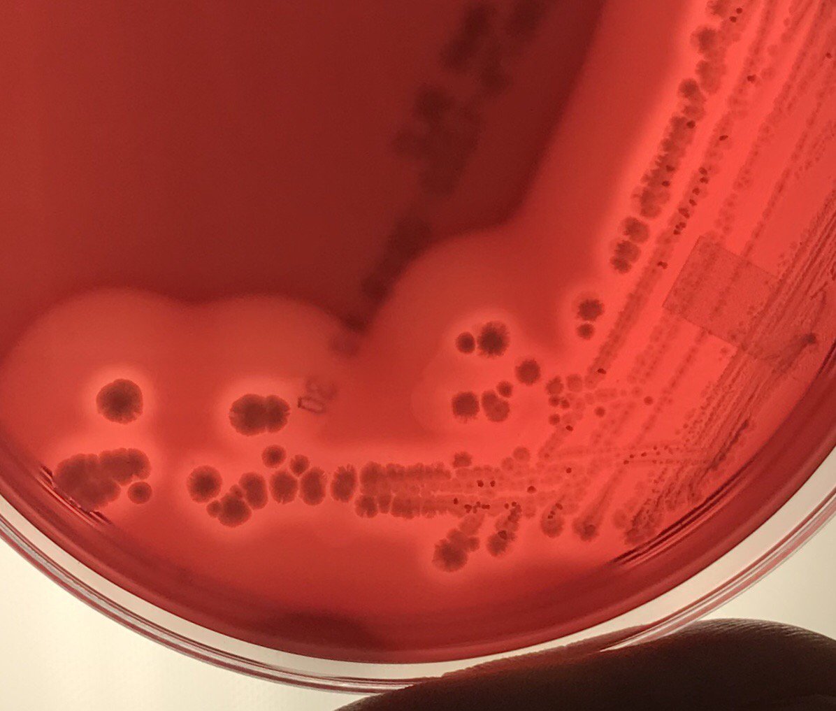 Clostridium Perfringens Colony