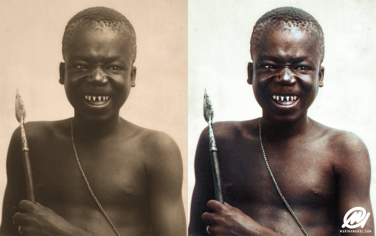 Pygmy People Teeth