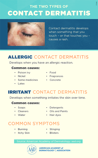 Contact Dermatitis Face Treatment