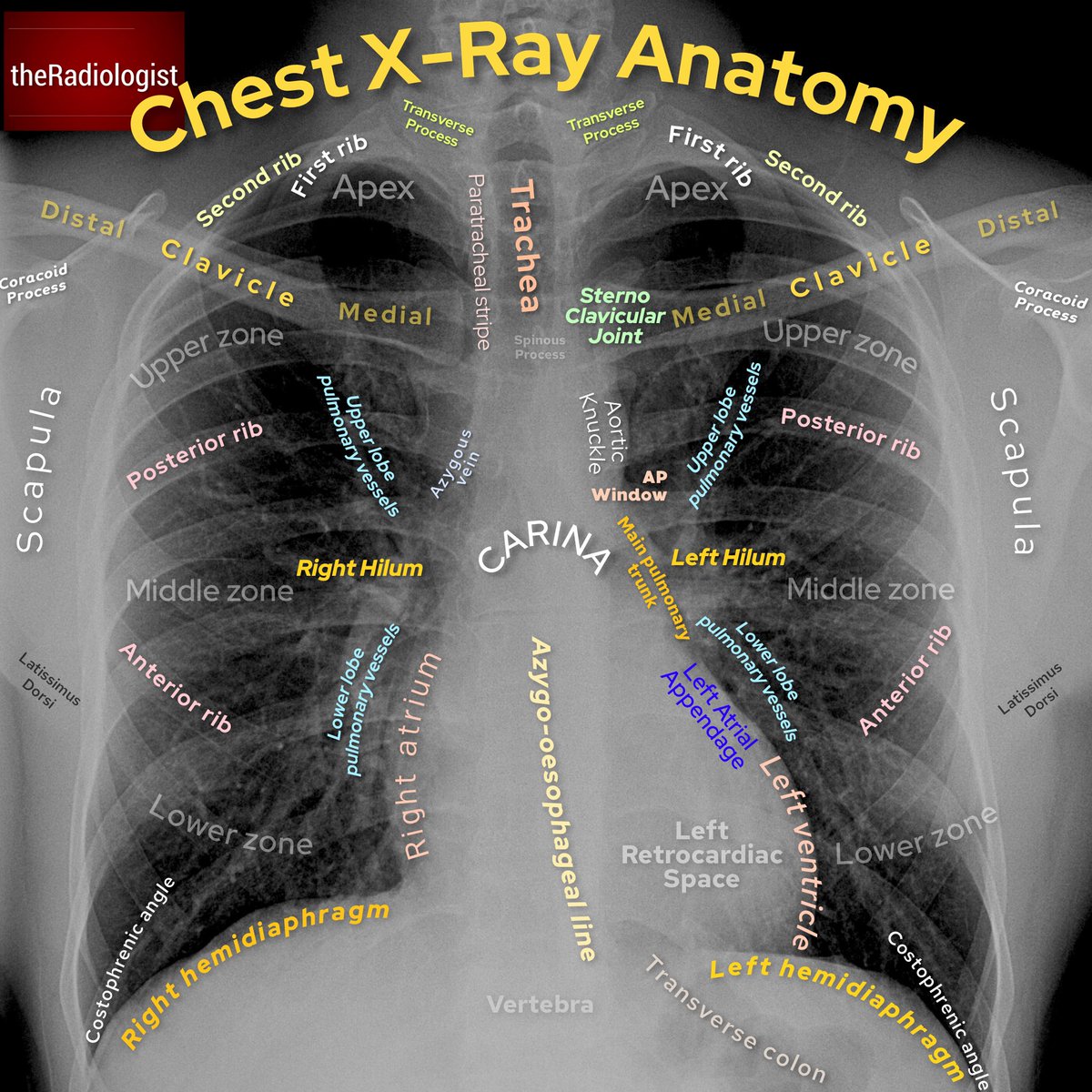 Normal Chest X Ray Labeled Normal Chest X Ray Labeled