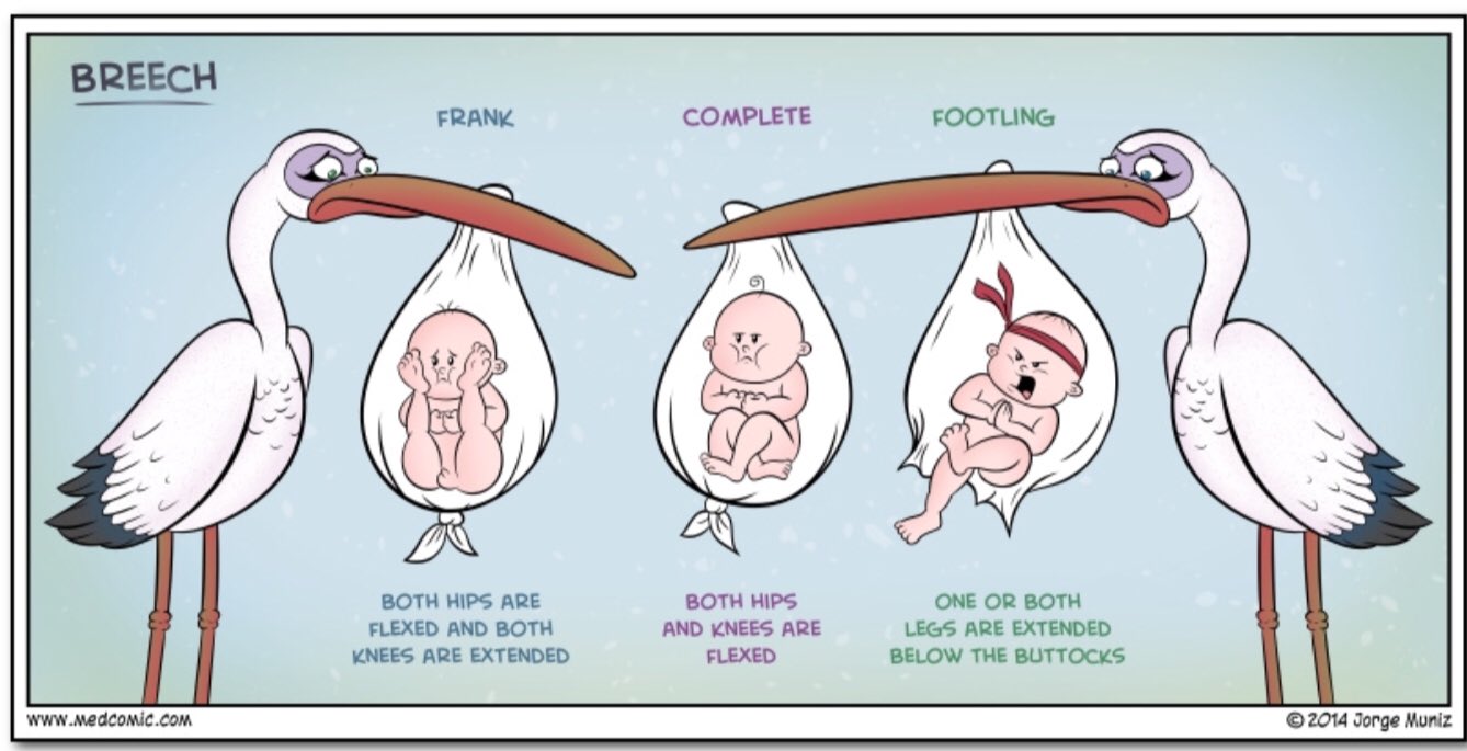 Breech Types