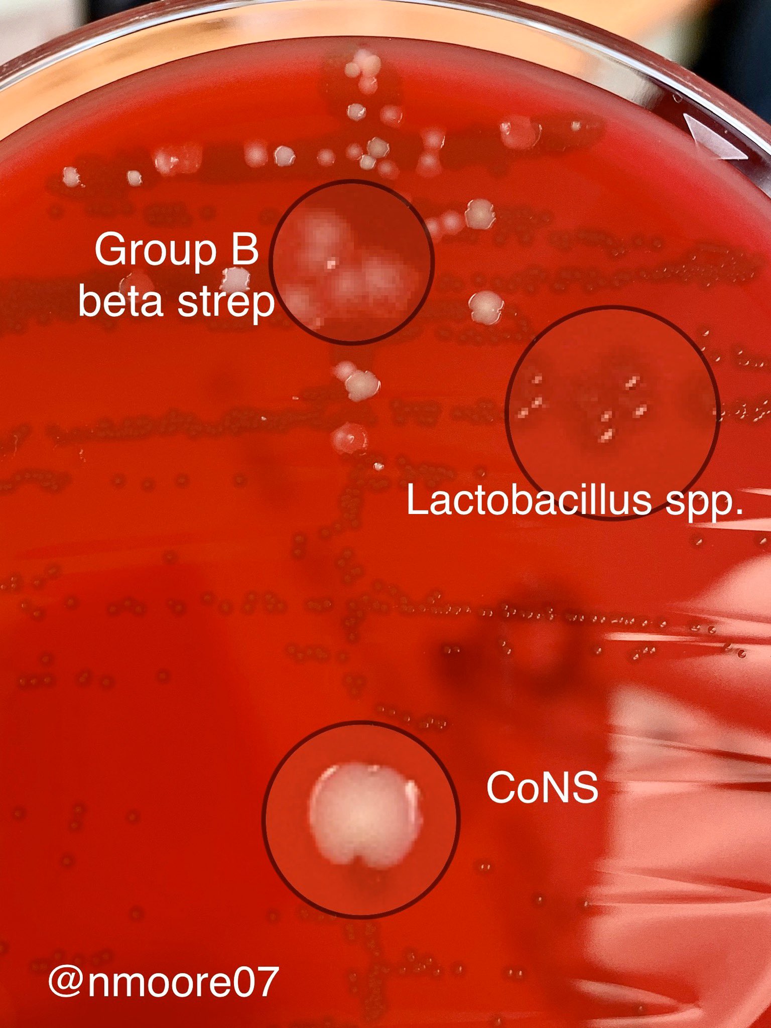 Alpha Hemolytic Staph