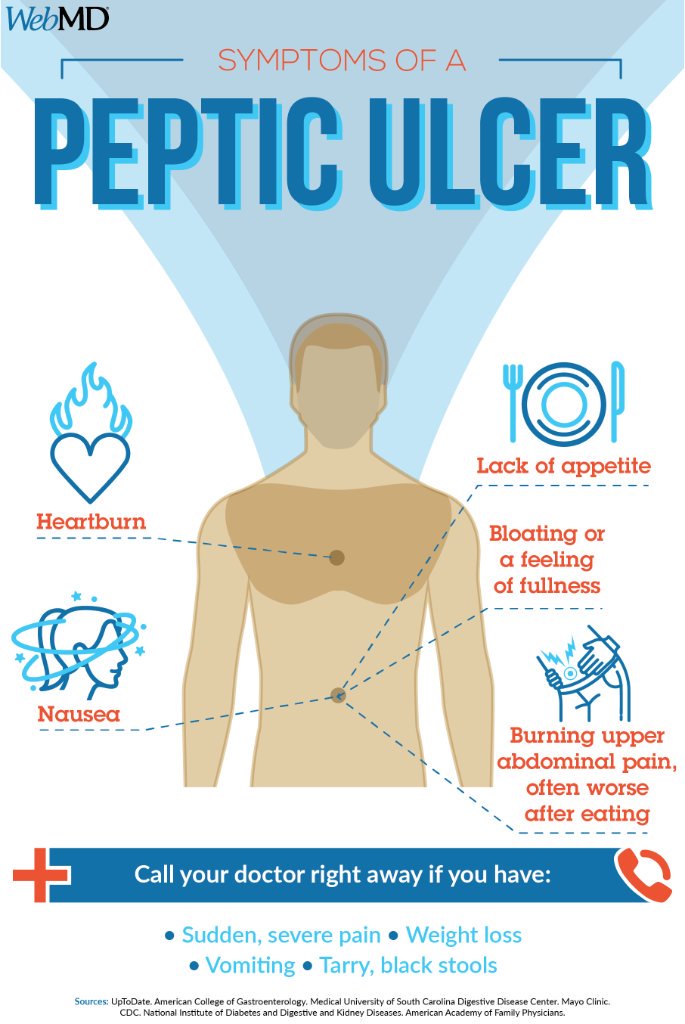 Stomach Ulcer Pain Location