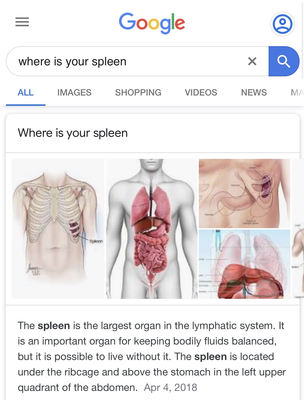 Living Without Your Spleen